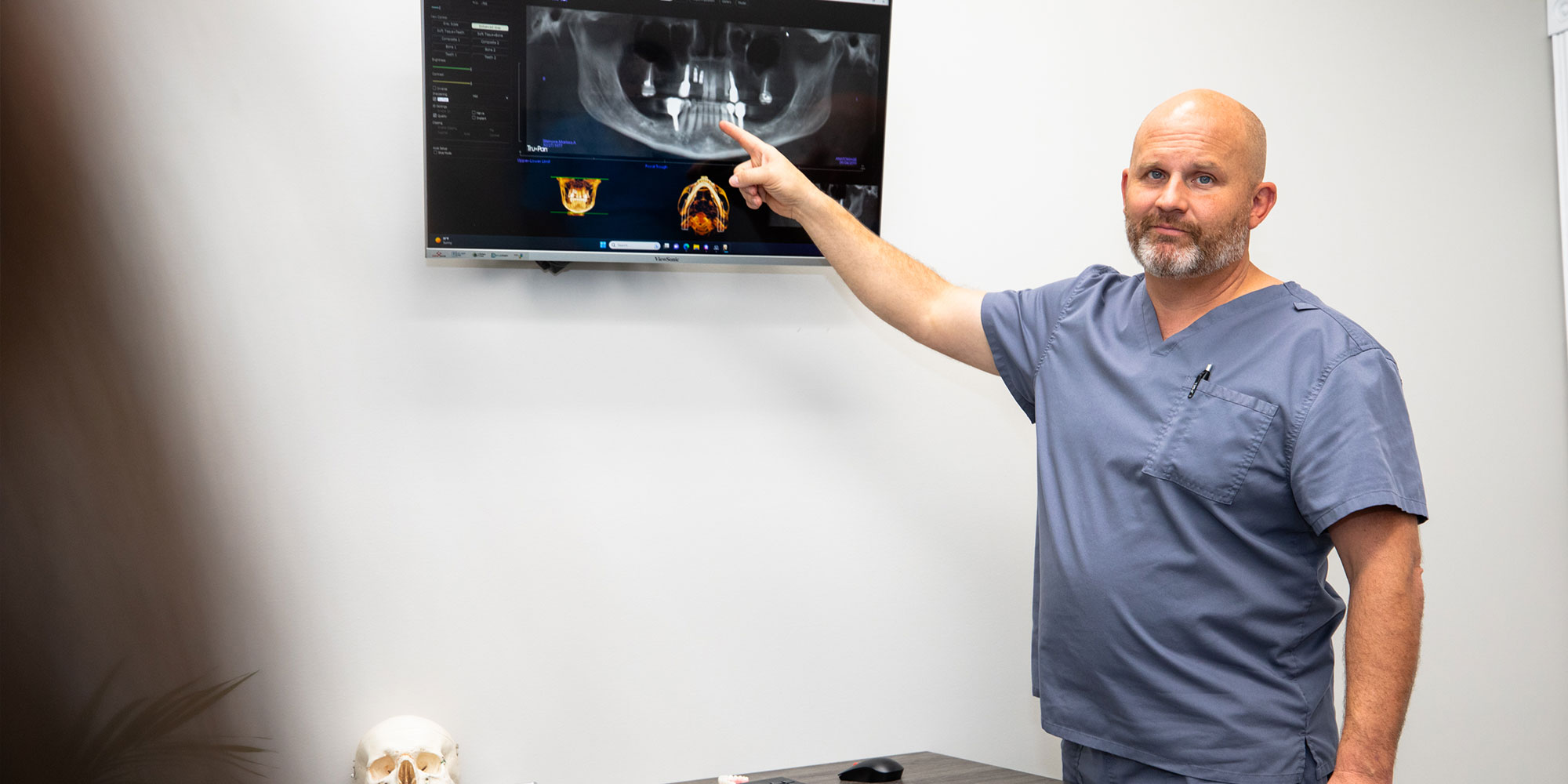 Tooth Extractions | Kearney, NE | Grand Island, NE | Heartland Oral Surgery